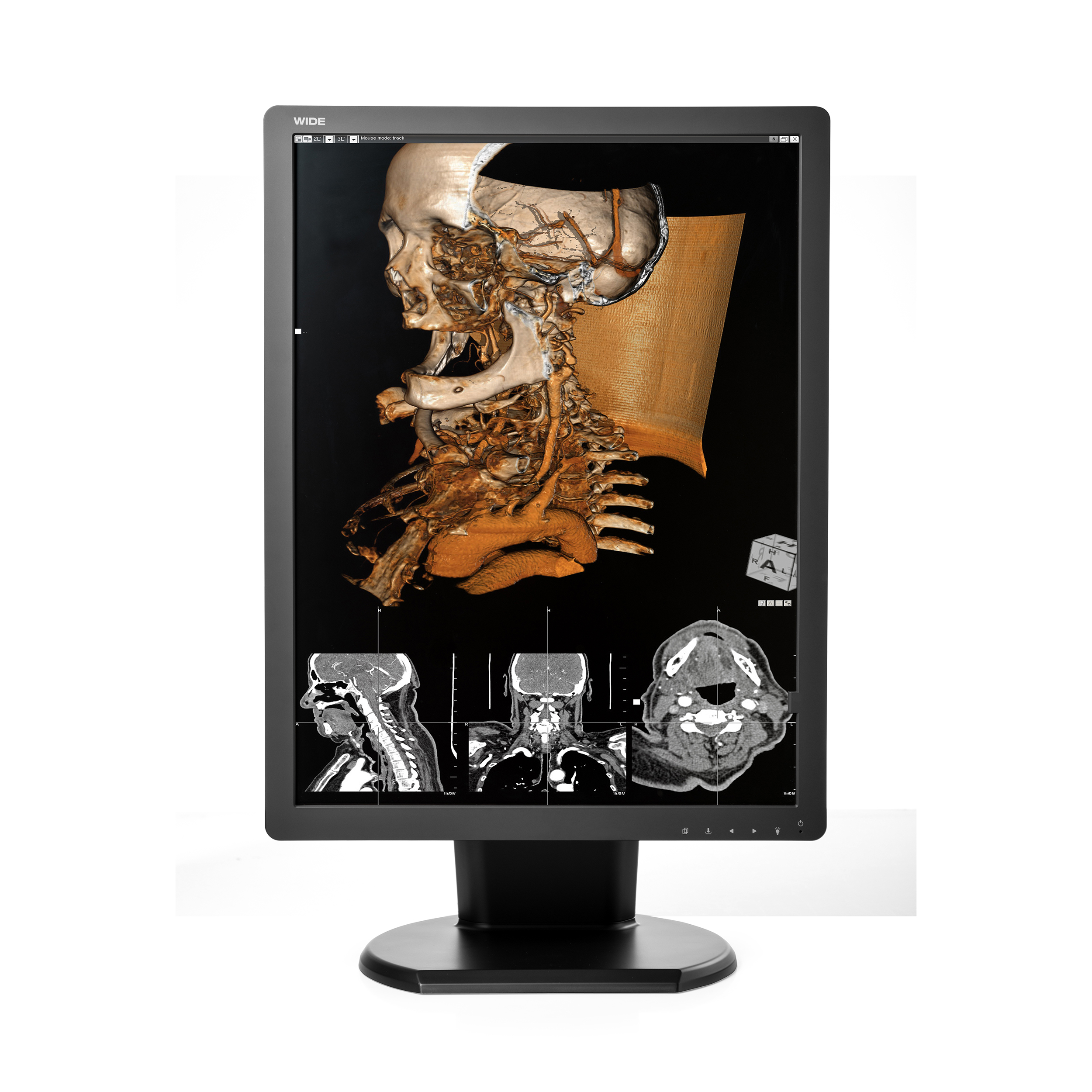 CX30N 21.3″ 3mp Diagnostic Color Display Klyo Medical Systems, Inc.